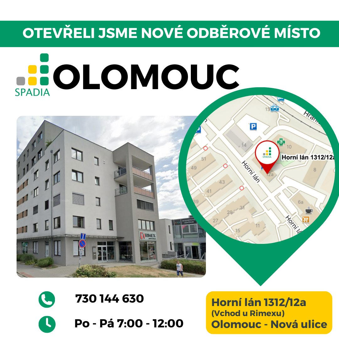 SPADIA míří do Olomouckého kraje | SPADIA